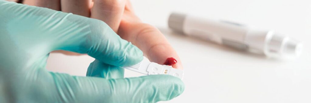 What is PT/INR Test and Why it’s Beneficial