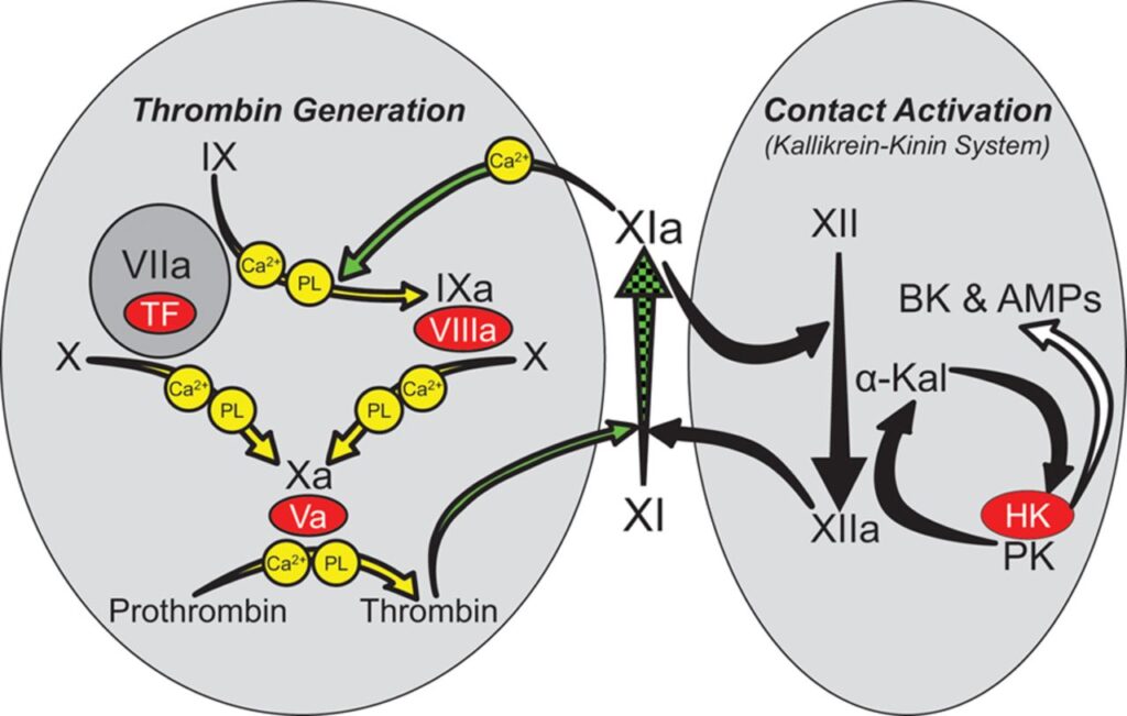 FACTOR XI DEFICIENCY- A BLOOD CLOTTING DISORDER