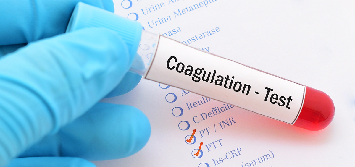 A BRIEF SUMMARY OF DIFFERENT COAGULATION TESTS AND THEIR PURPOSE.