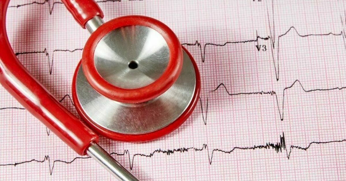 WHAT YOU NEED TO KNOW ABOUT LONGSTANDING PERSISTENT ATRIAL FIBRILLATION