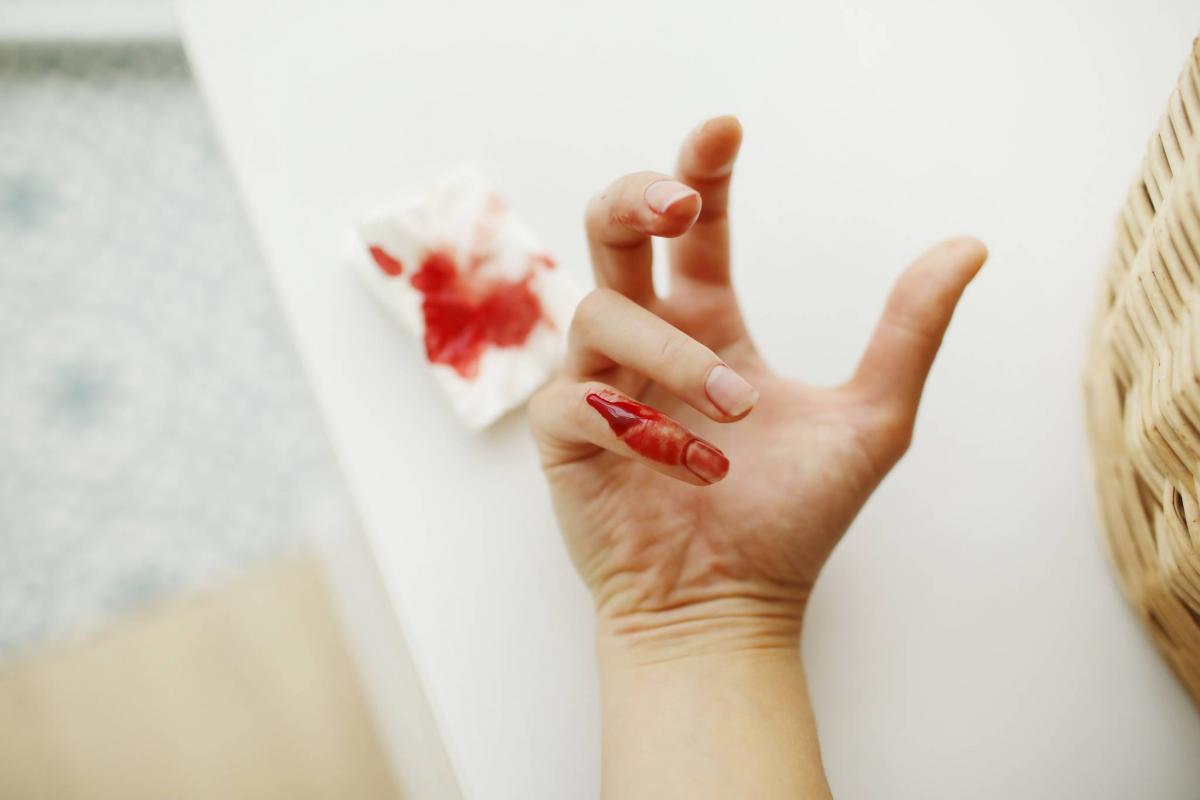 UNDERSTANDING BLEEDING RISKS WITH HIGH INR: WHEN TO SEEK MEDICAL ATTENTION